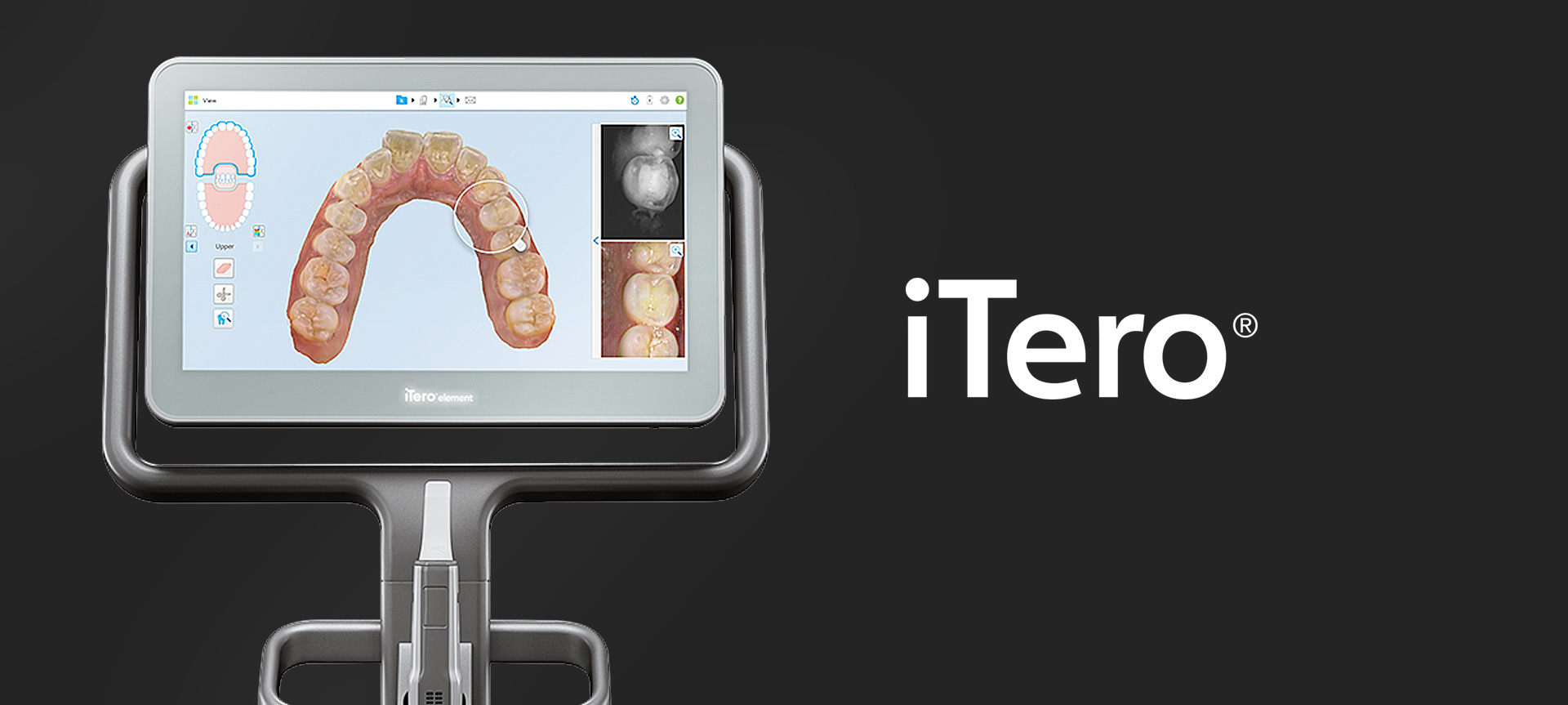 iTero Scanner - Clínica Implantec